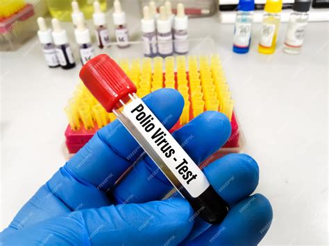 Premium Photo Closeup Of Scientist Or Medical Worker Hand Hold Blood