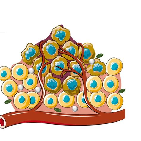 Schematic Illustration Of Tumor Microenvironment Tumor Cells Live In A