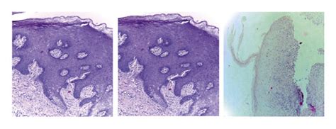 Different Classes Of Histopathological Images With A Neor And B