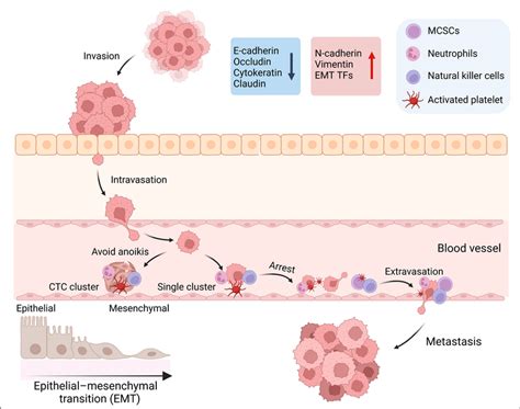A Schematic Representation Highlights The Role Of Emt In Tumor