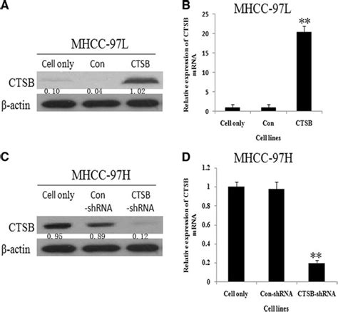 Ctsb Expression In Mhcc 97 L And Mhcc 97h A Ctsb Protein Of Mhcc 97 L