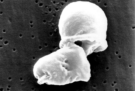 Free Picture Malassezia Fungal Organisms