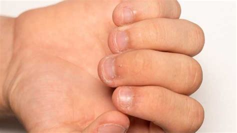 Conoce Los Peligros Del Metil Metacrilato En Las Uñas Acrílicas