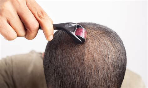 Derma Roller For Hair Loss Scalp Roller For Hair Growth