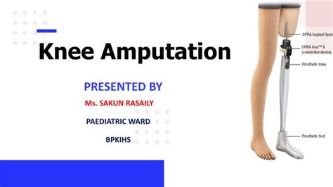 Knee Amputation Pptx
