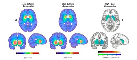 Caffeine Effects On Brain
