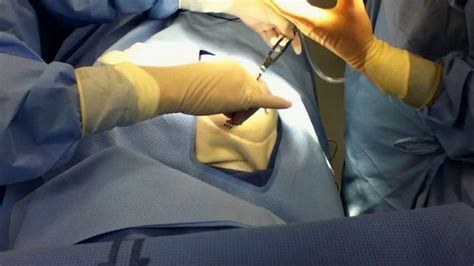 Cervical Biopsy Forceps