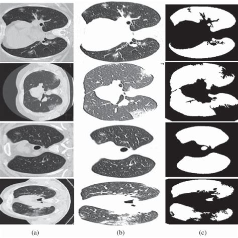 Lung Region Of Segmentation A Original Ct Image B Lung Region C Download Scientific