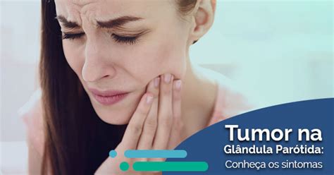 Tumor Na Glandula Parotida