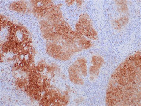 Stathmin Recombinant Antibody Ivd Antibody Zeta Corporation