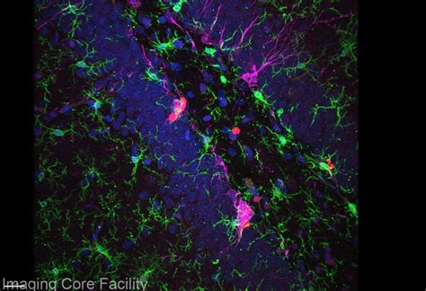 Dapi Pcna Dcx Iba1 In Hippocampus College Of Arts And Sciences