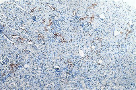 Calbindin D28k Antibody 66394 1 Ig Proteintech 武汉三鹰生物技术有限公司