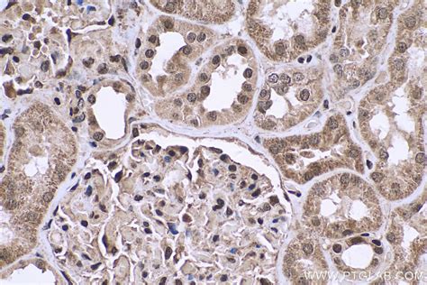 Ihceasy Hmgb1 Ready To Use Ihc Kit Khc0736 Proteintech