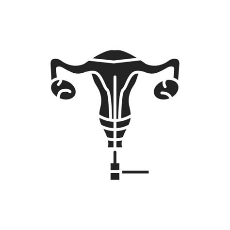 110 Hysteroscopy Stock Illustrations Royalty Free Vector Graphics