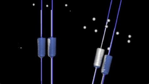 Figure 4 From Comparison Of Implant Placement Accuracy In Healed And Fresh Extraction Sockets