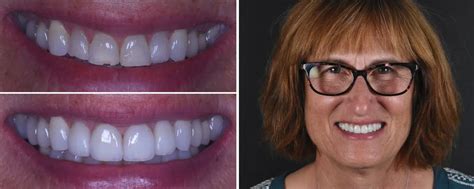 New Patients Skyline Dental