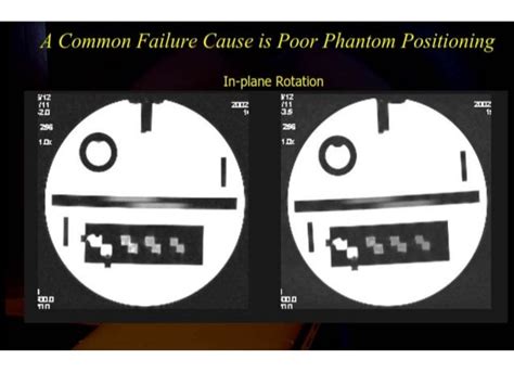 mri quality control acr phantom pro mri