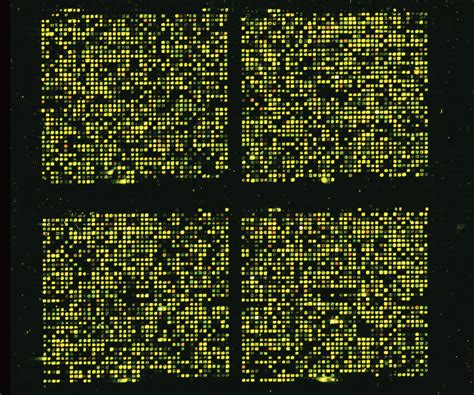 Microarray 01 National Institute Of General Medical Sciences