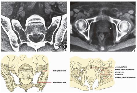 Lower Limb I Pelvic Girdle And Proximal Femur Radiology Key