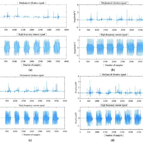 The Original Signal After Noise Reduction In Four States A Normal
