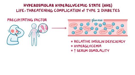 Hyperosmolar Hyperglycemic State Clinical Sciences Osmosis Video Library