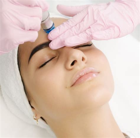 Microneedling Microneedling Facial London Dermacure