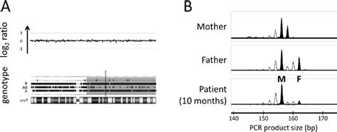 Copy Number Variation Analysis And Loss Of Heterozygosity Loh Download Scientific Diagram