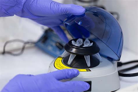 중합효소 연쇄 반응 및 아가로즈 젤 전기 동아나는 실험실에서 생화학 분자 생물학 유전학 및 임상 화학에 사용되는 젤 전기 동거의 방법입니다 사슬에 대한 스톡 사진 및 기타