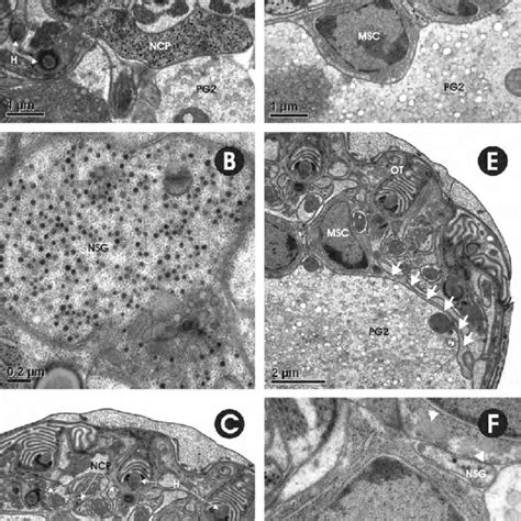 Transmission Electron Micrographs Showing The Details Of Nerve And