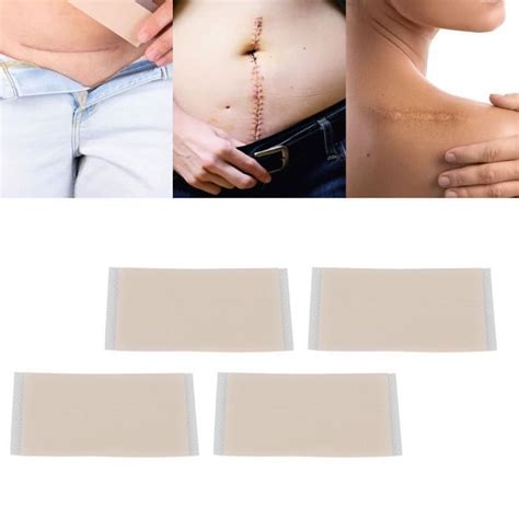 Feuilles d élimination des cicatrices en silicone Patch de cicatrice en gel professionnel