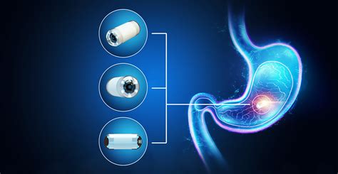 Capsule Endoscopy Prof Dr Cengiz Pata