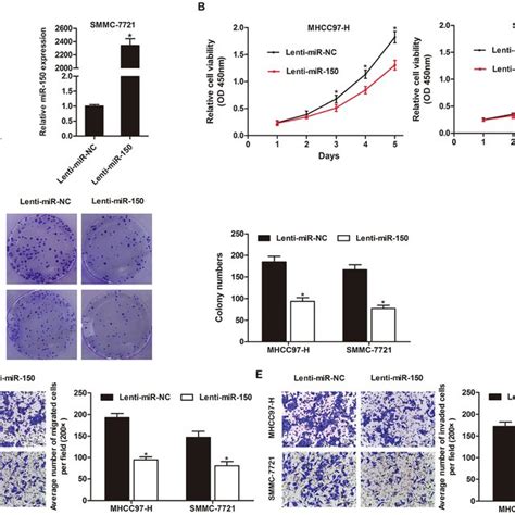 Mir 150 Inhibits Hcc Cell Proliferation Colony Formation Migration