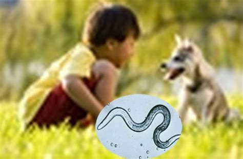 CÁch NhẬn BiẾt TrẺ BỊ NhiỄm Giun SÁn DÀnh Cho Ba MẸ