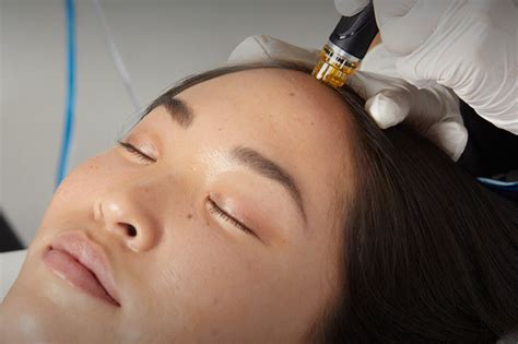 Scalp Treatment Keravive Scalp Treatment By Hydrafacial