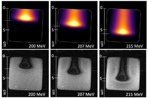 Proton Versus Carbon Ion Therapy Model Compares Secondary Cancer Risks Physics World