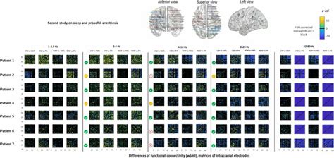individual anatomical data and functional connectivity matrices on the