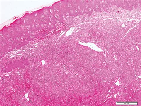 Hard Palate Histology