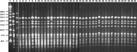 Pfge Patterns Generated By Smai Digestion Of S Pneumoniae Serotype 5 Download Scientific
