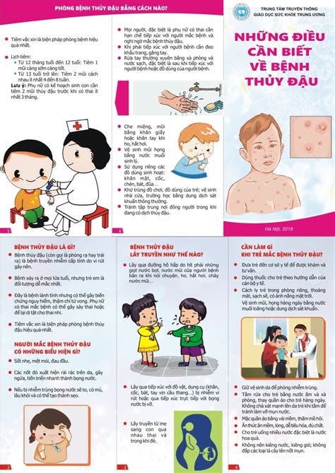 Những điều Cần Biết Về Bệnh Thủy đậu