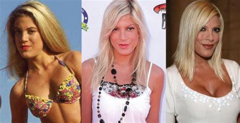 Tori Spelling Plastic Surgery Before And After Pictures 2024
