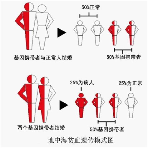 地中海貧血的症狀和體徵是什麼 每日頭條