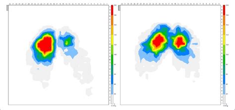 Example Of Pressure Mapping Without And With Brace Download Scientific Diagram