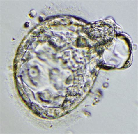Scientists Create Complete Model Of Human Embryo Without Sperm Nor