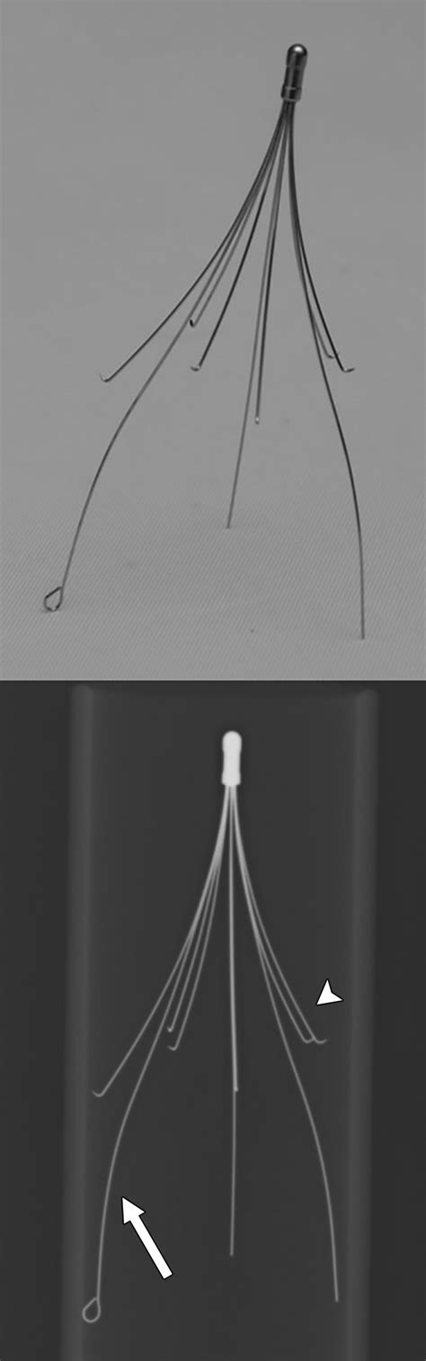 Gunther Tulip Ivc Filter