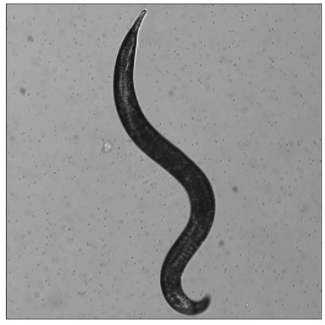 Celegans Worm Detection Object Detection Dataset And Pre Trained Model By Celegans