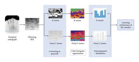 The Proposed Method For Automatic Segmentation To Detect Osteoporosis Download Scientific