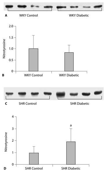Western Blot Analysis Of Renal Cortical Nitrotyrosine Representative