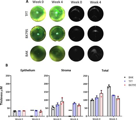 No Inflammation Associated Increase In Corneal Thickness Is Observed In