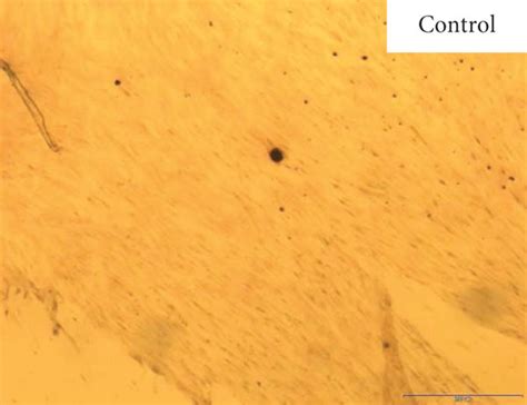 Alizarin Red Staining And Mineralization Assay Of Human Adipose Stem