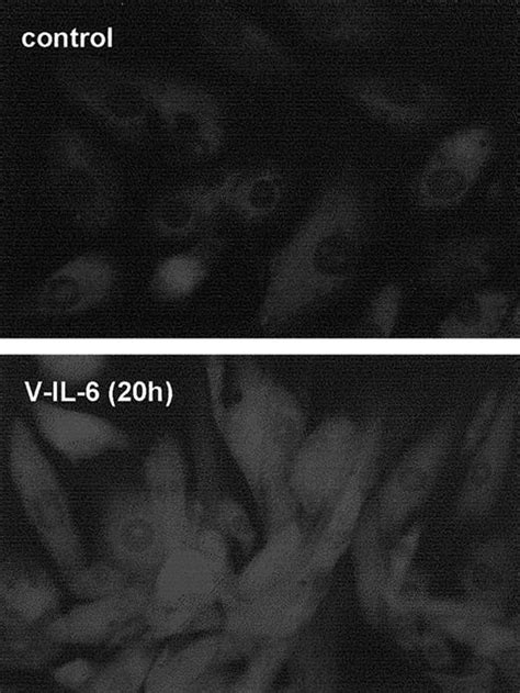 Il 6 Receptor Independent Stimulation Of Human Gp130 By Viral Il 61